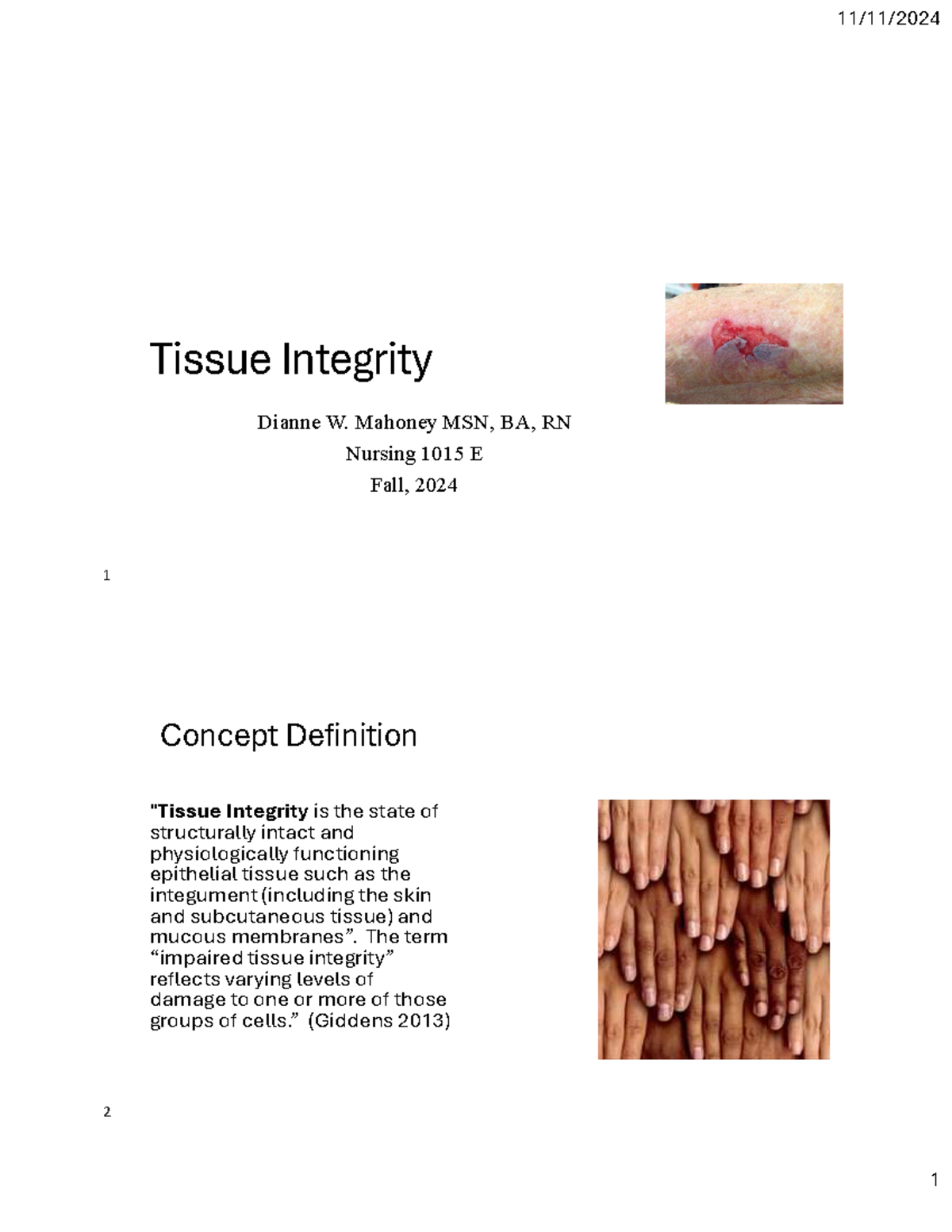 Tissue Integrity - Tissue Integrity Dianne W. Mahoney MSN, BA, RN ...