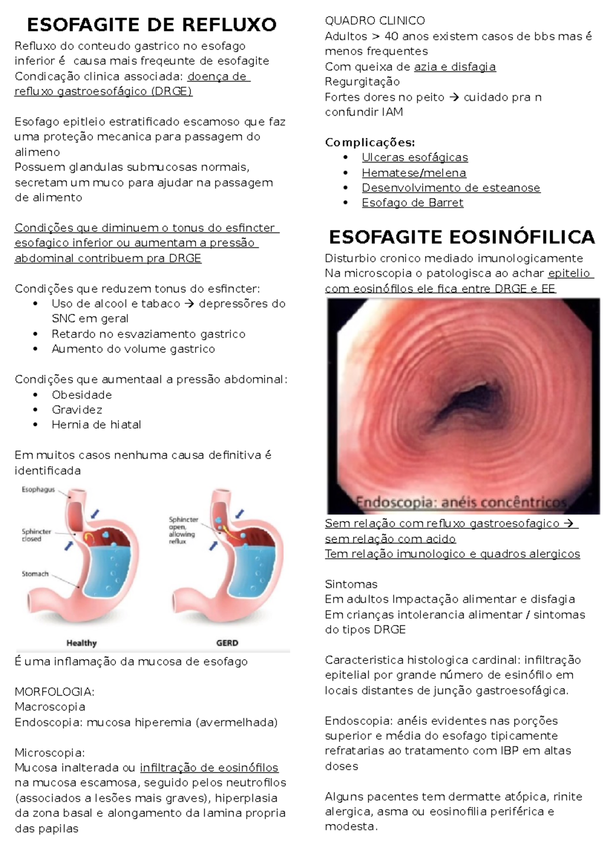 Caso 6 DRGE e tumores esogafo - ESOFAGITE DE REFLUXO Refluxo do ...