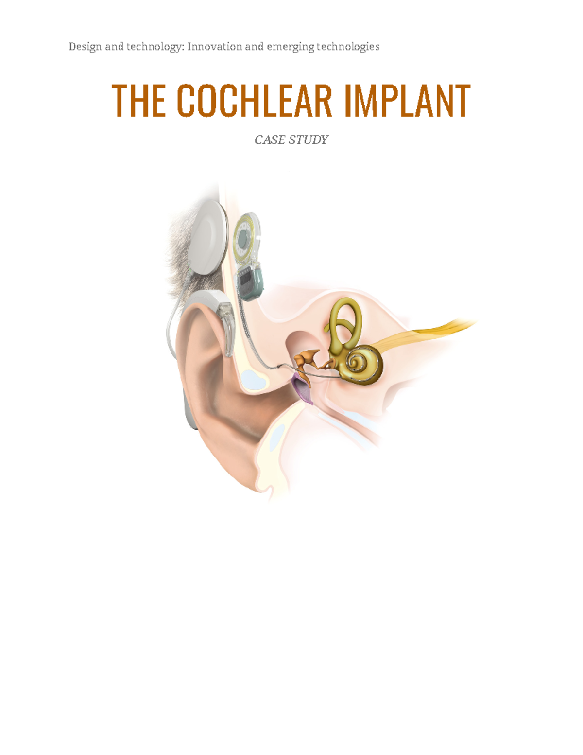 The Cochlear Implant - Gisele Obeid - Design and technology: Innovation ...