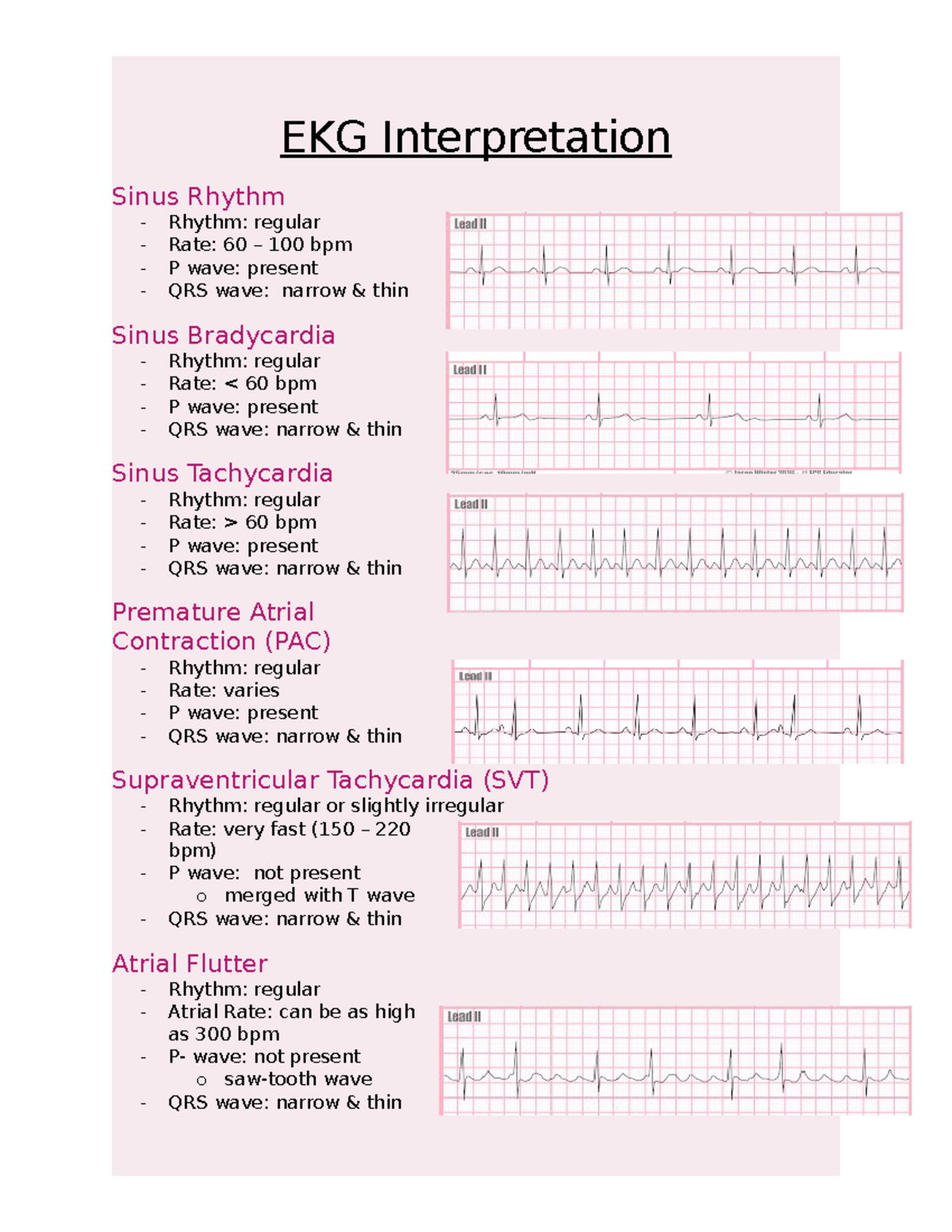 Dysrrhythmia Identification - EKG Interpretation Sinus Rhythm - Rhythm ...