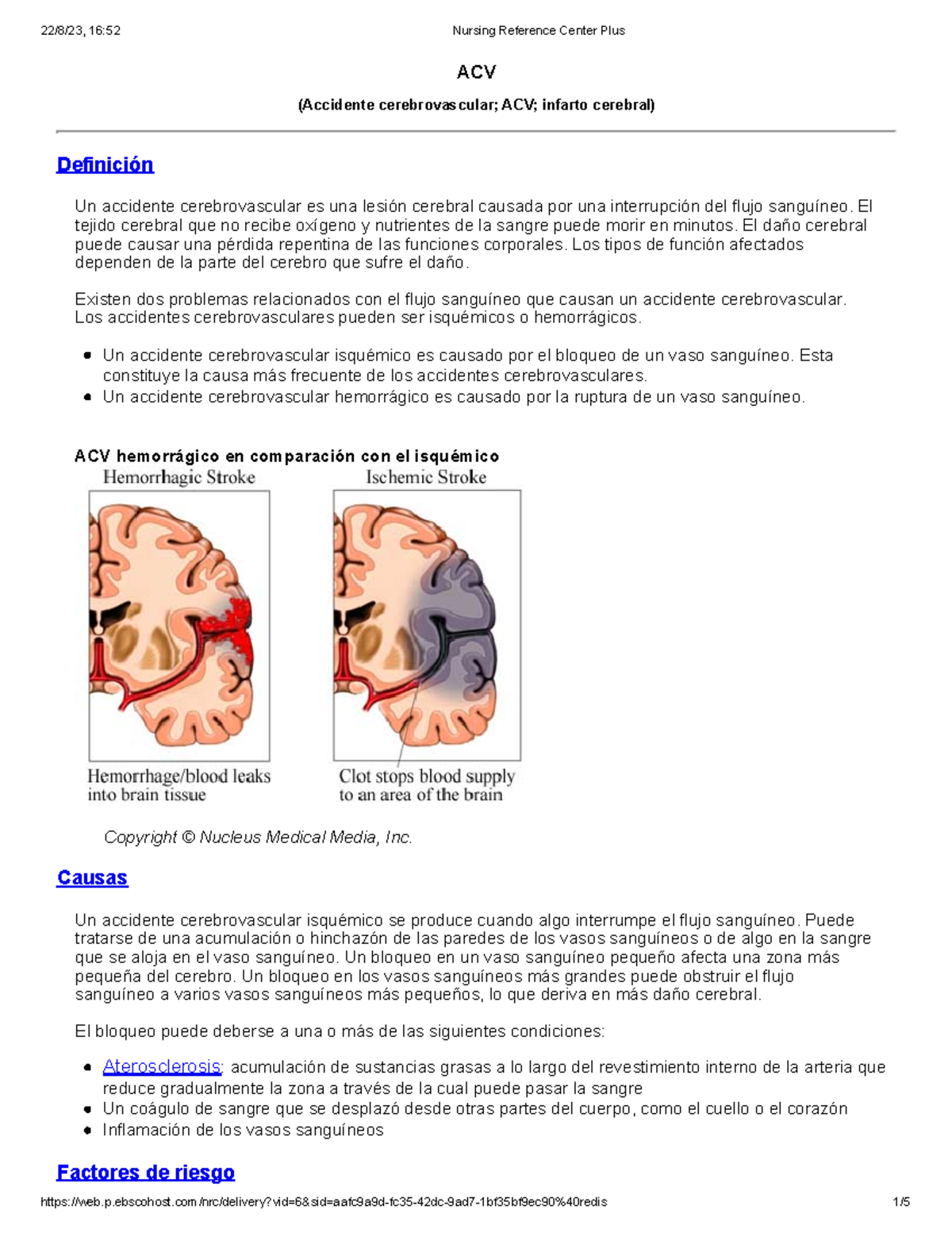 ACV Isquemico - Guía MINSAL - ACV (Accidente cerebrovascular; ACV ...