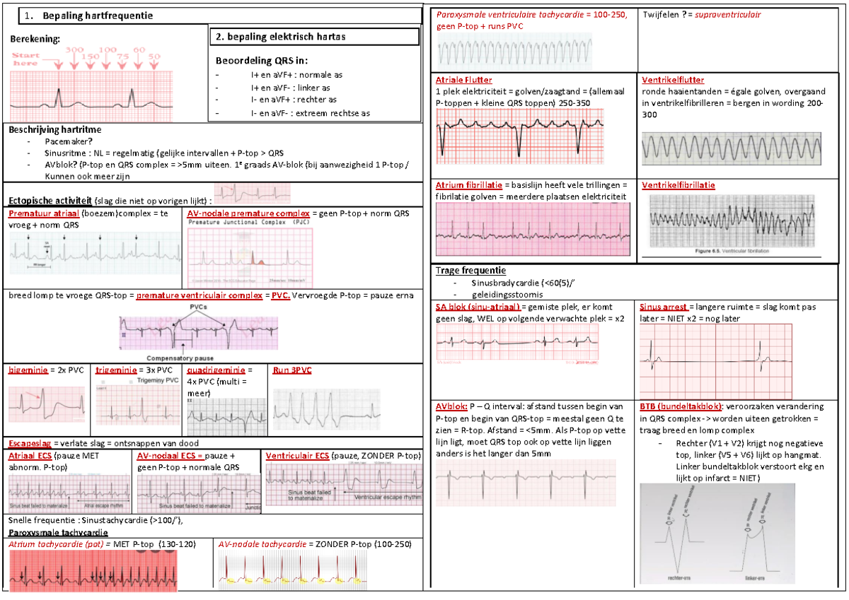 AFP3 ecg spiekbrief - Shalina Verdijck / AFP3 / ECG 1. Bepaling ...