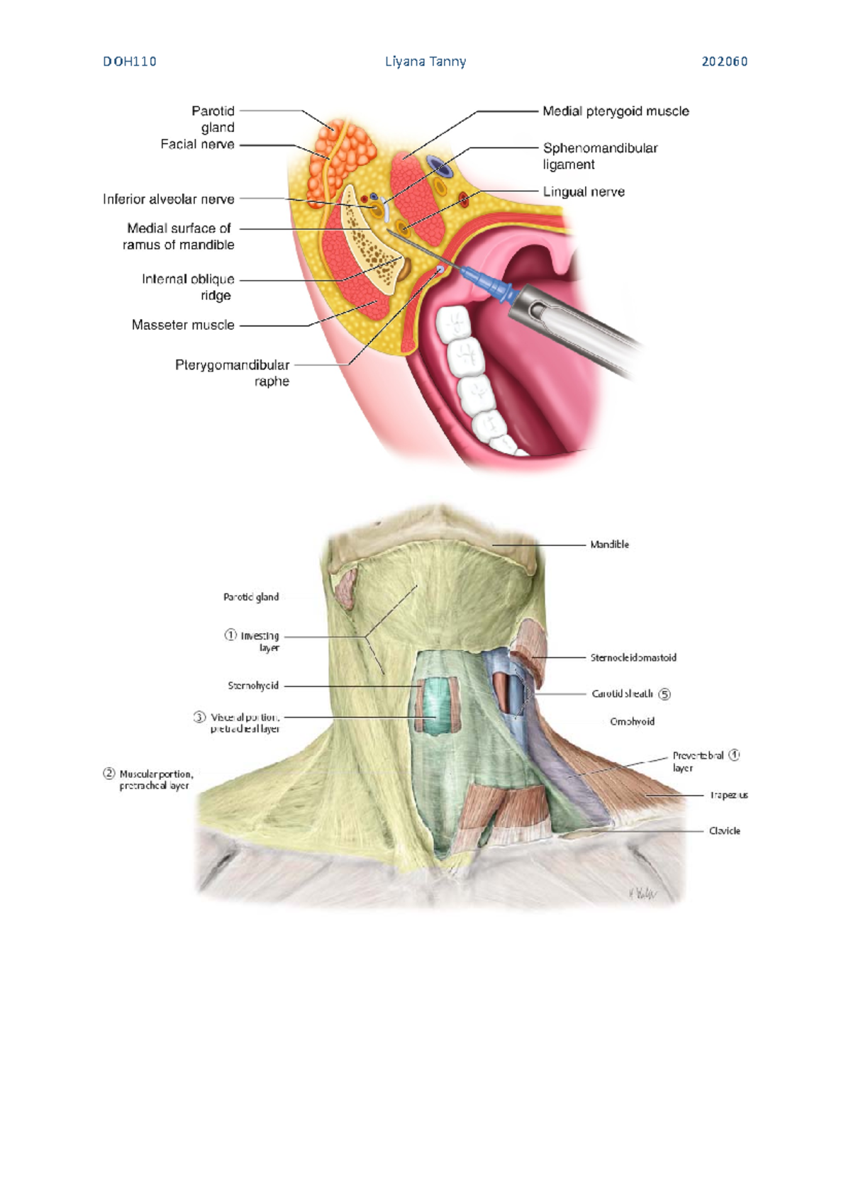 Answers Fascia and Spaces Tutorial(1)(1)(1) - R: Ramus, IAN: inferior ...