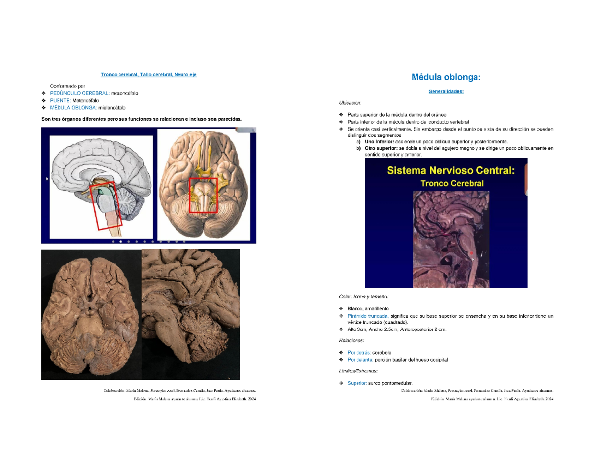 Tronco cerebral. aula - Tronco cerebral, Tallo cerebral, Neuro eje ...