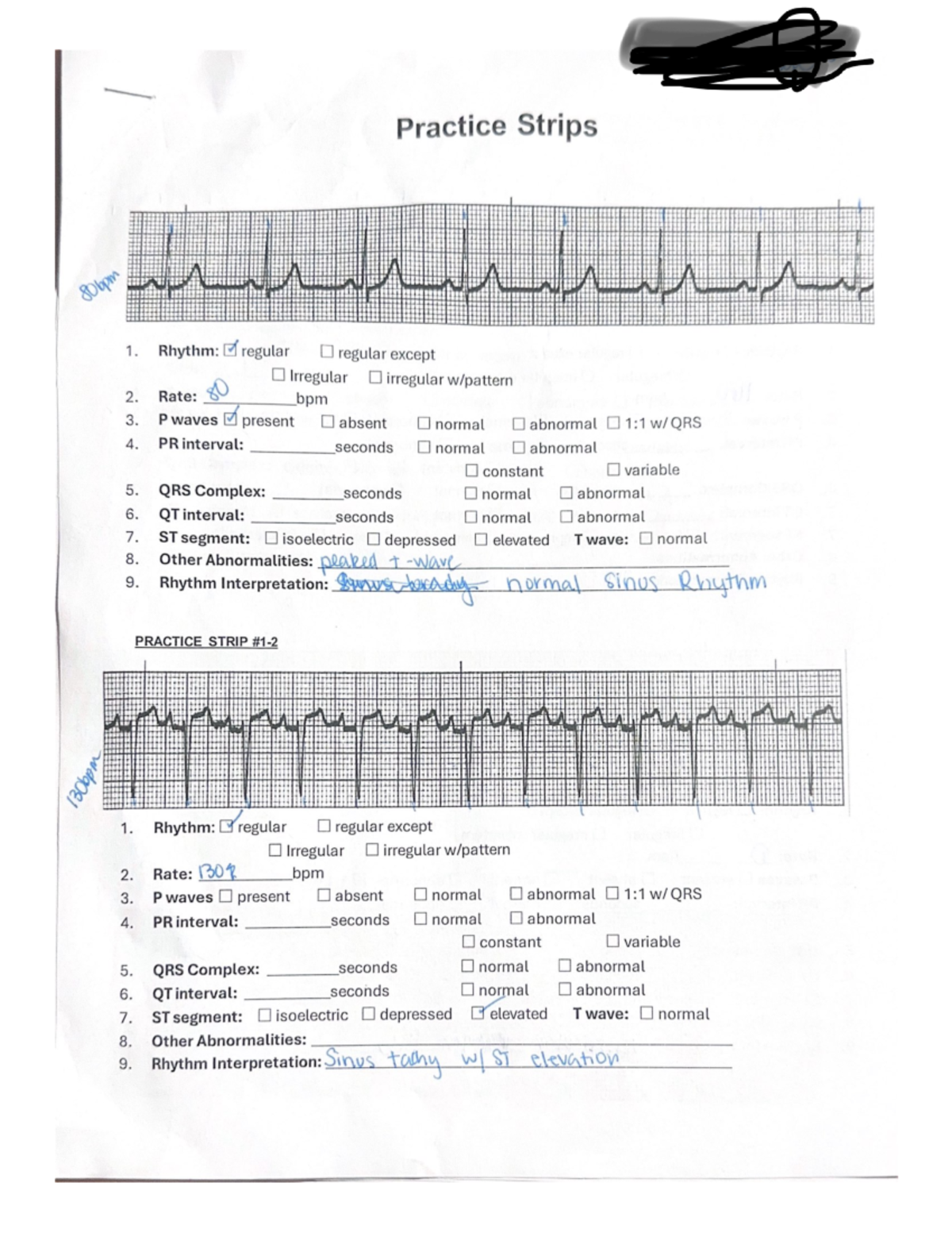Practice Strips - EKG, partial assignment - Practice Strips // 1 ...