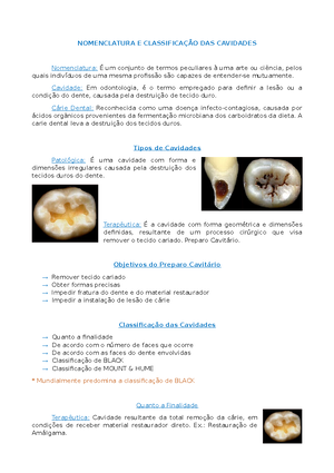 5- Determinação DO Limite Apical DO Preparo Endodôntico - DETERMINAÇÃO ...