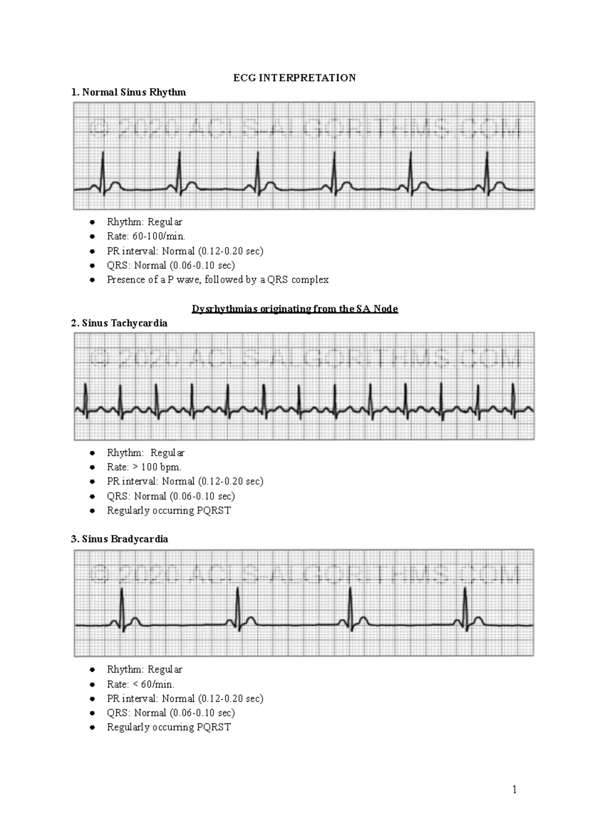 ECG-Interp-Review - ECG INTERPRETATION 1. Normal Sinus Rhythm Rhythm: Regular Rate: 60-100/min ...