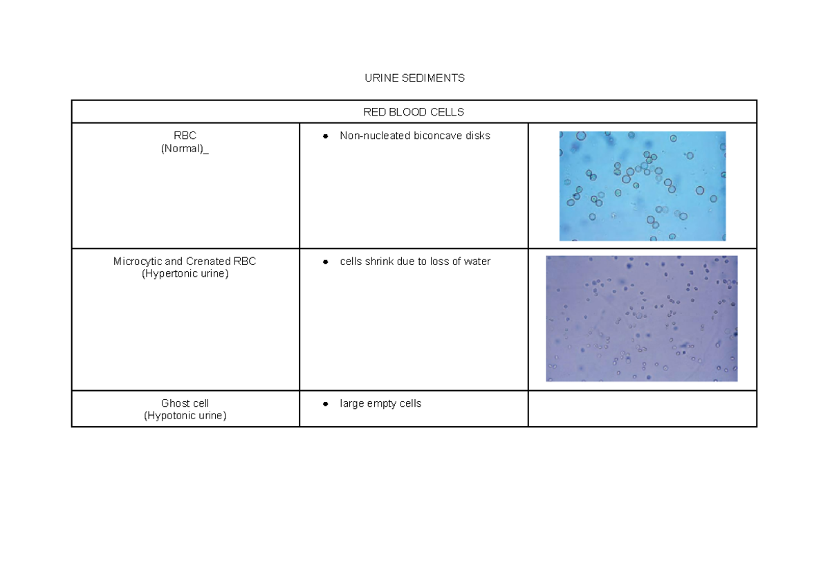 Att - none - URINE SEDIMENTS RED BLOOD CELLS RBC (Normal)_ Non ...