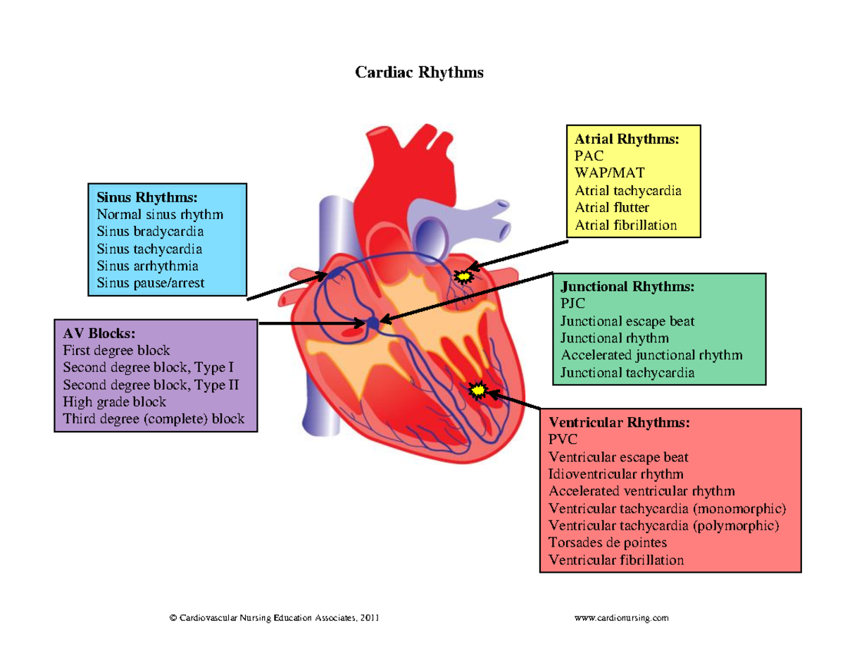 Cardiac Arrhythmias Reference Chart - Cardiac Rhythms Sinus Rhythms ...