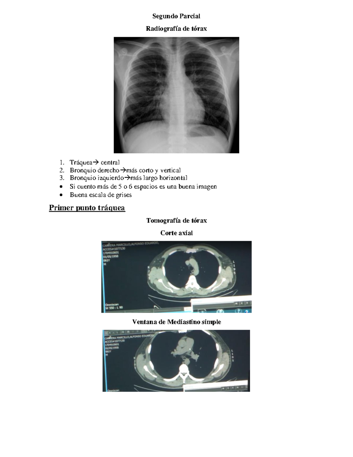 Rx de tórax - Segundo Parcial Radiografía de tórax Tráquea→ central ...