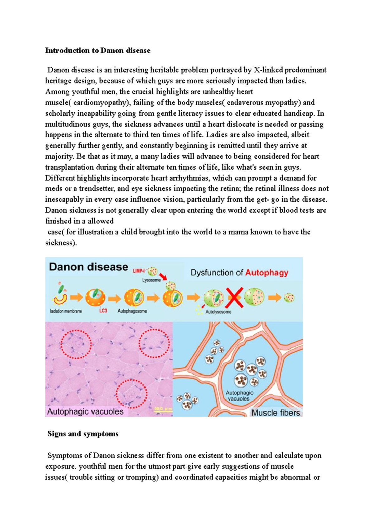 Signs and Symptoms of Danon Disease - Introduction to Danon disease ...