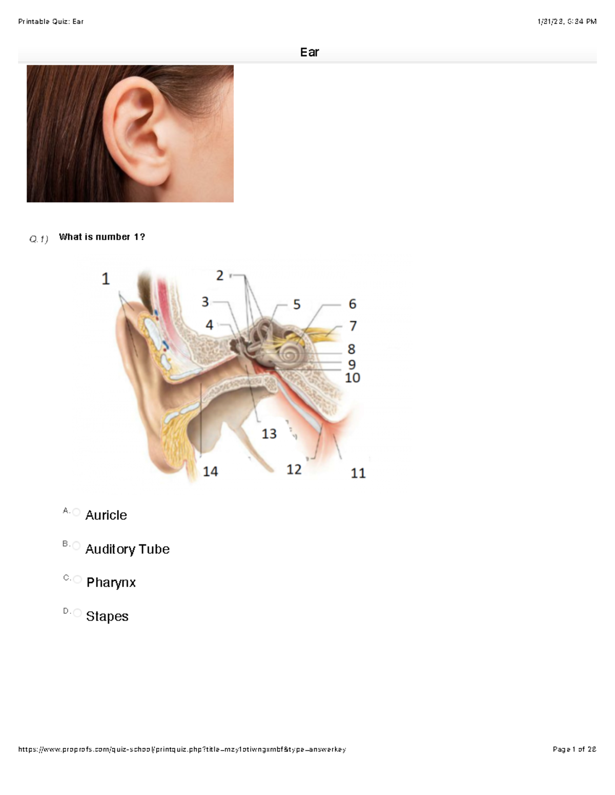 Ear practice quiz - Q) What is number 1? Auricle A. Auditory Tube B ...