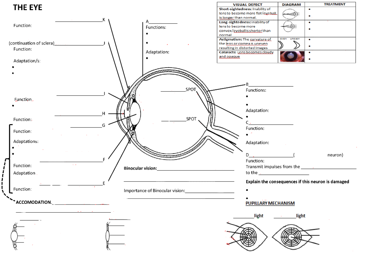 4.1 one pager eye-1 - It so important - VISUAL DEFECT DIAGRAM TREATMENT ...
