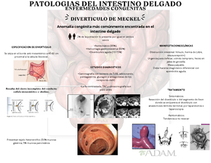 Apendicitis - Resumen Cirugía General - Inflamación del apéndice cecal ...