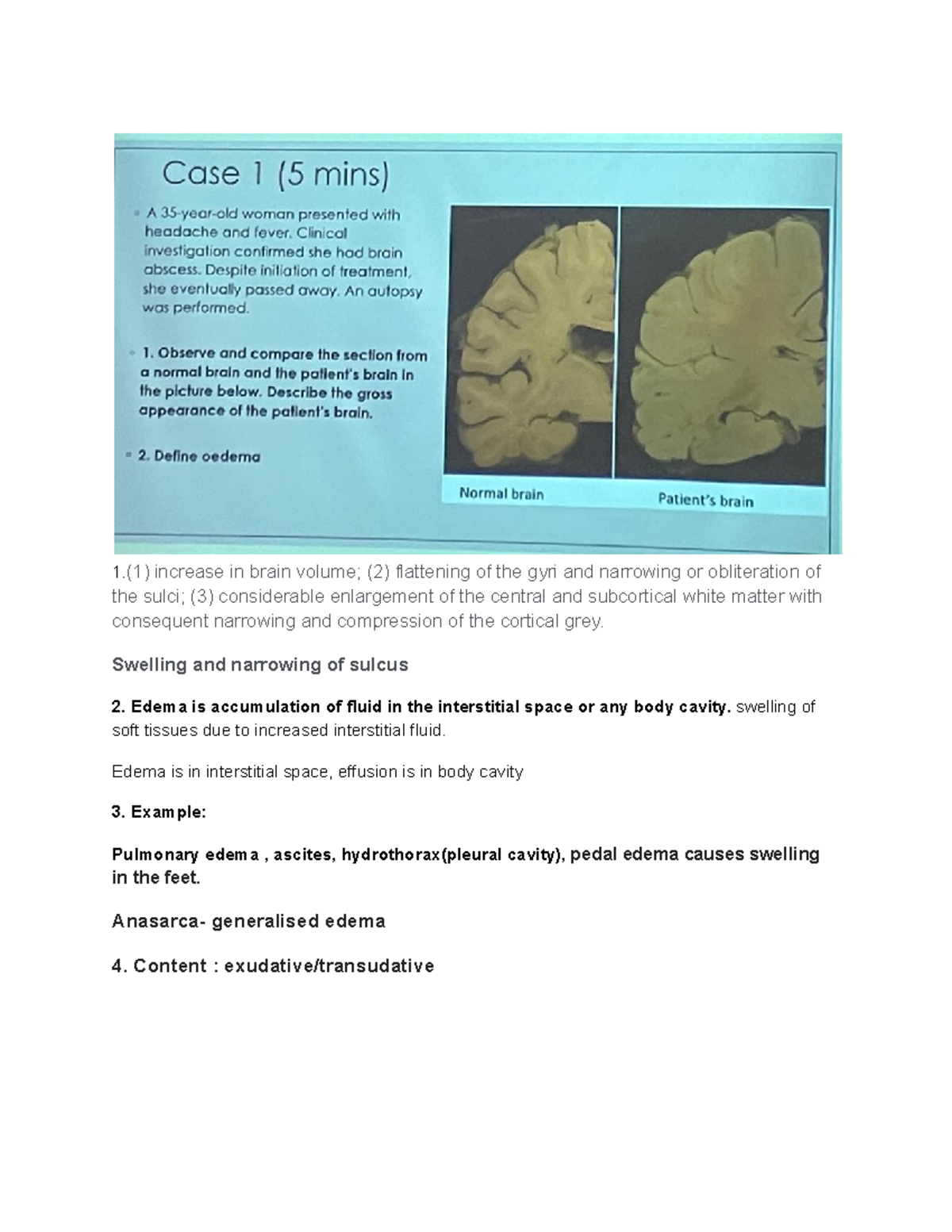 Edema - Full and compact note - 1.(1) increase in brain volume; (2 ...