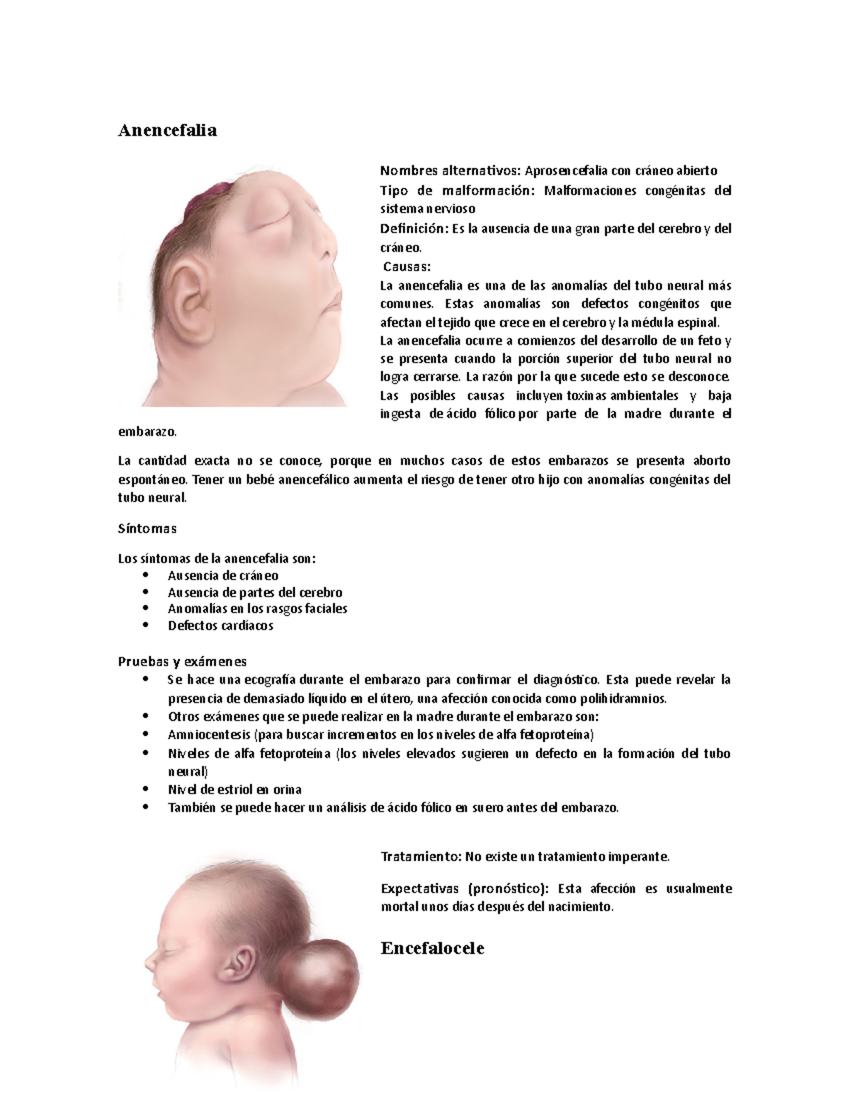 Atlas de malformaciones - Anencefalia Nombres alternativos ...