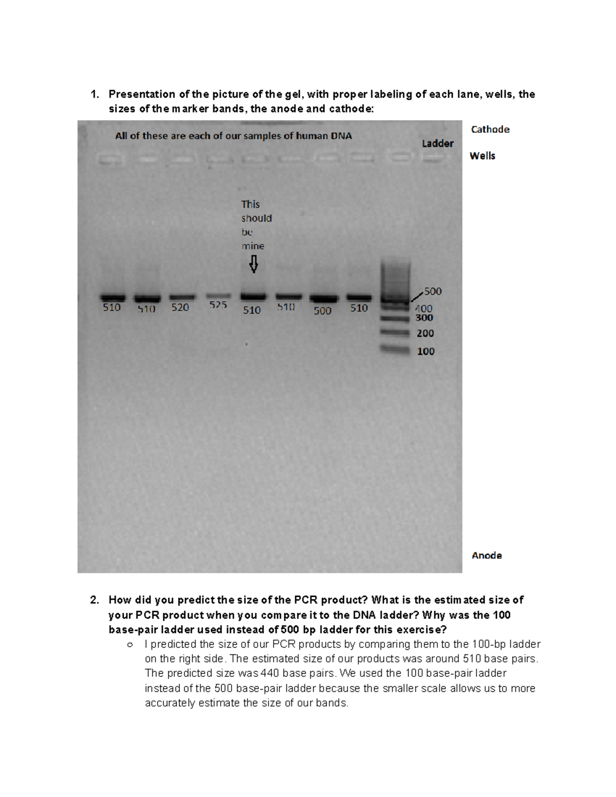 BIOL 2281 Lab - E7 Report - Presentation of the picture of the gel ...