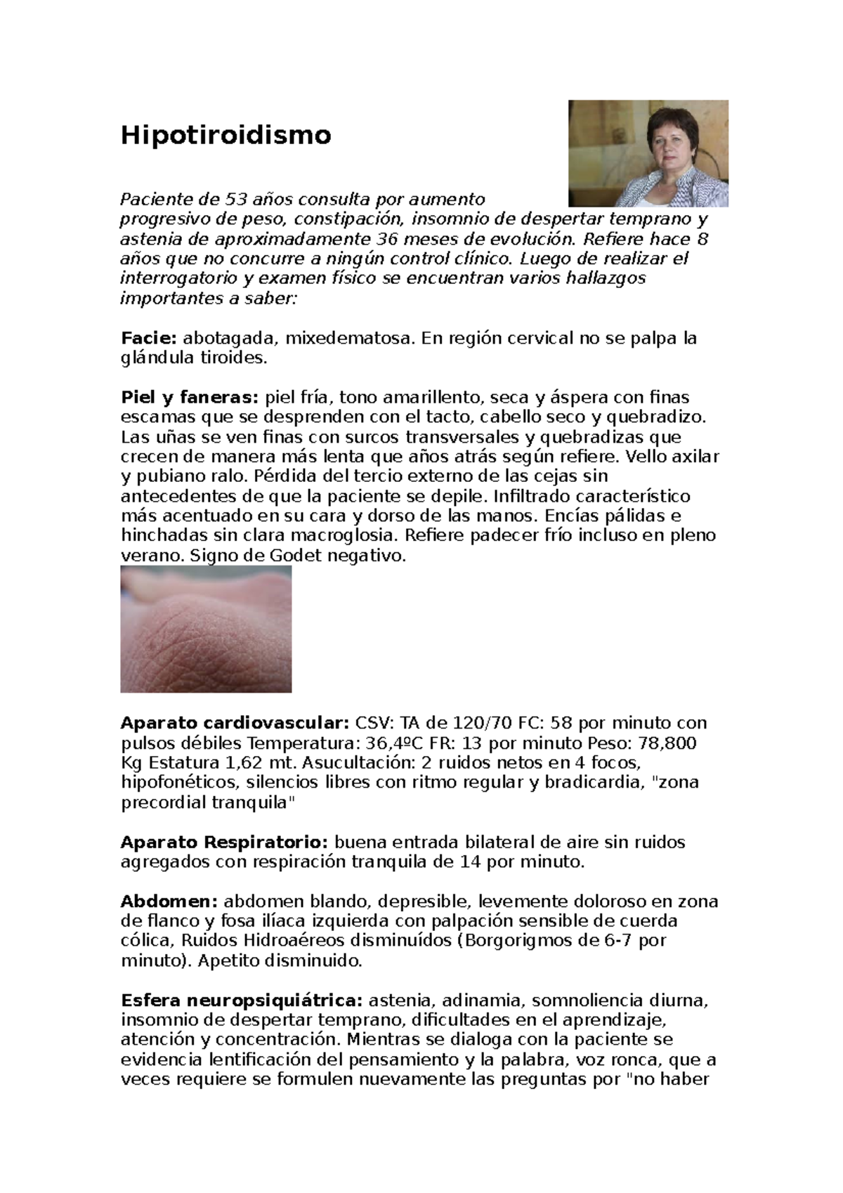 CASO Clinico- Hipotiroidismo - Hipotiroidismo Paciente de 53 años consulta por aumento ...