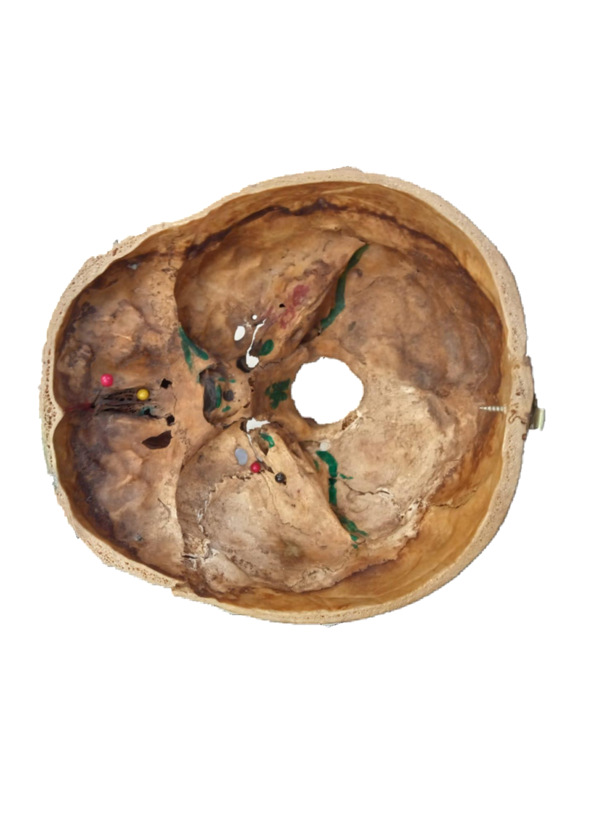 Cráneo - imagenes de craneo - Anatomia y Anatomia - Studocu