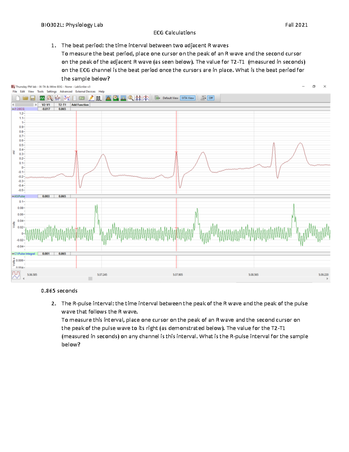 ECG Calculations Worksheet copy - BIO302L: Physiology Lab Fall 2021 ECG ...