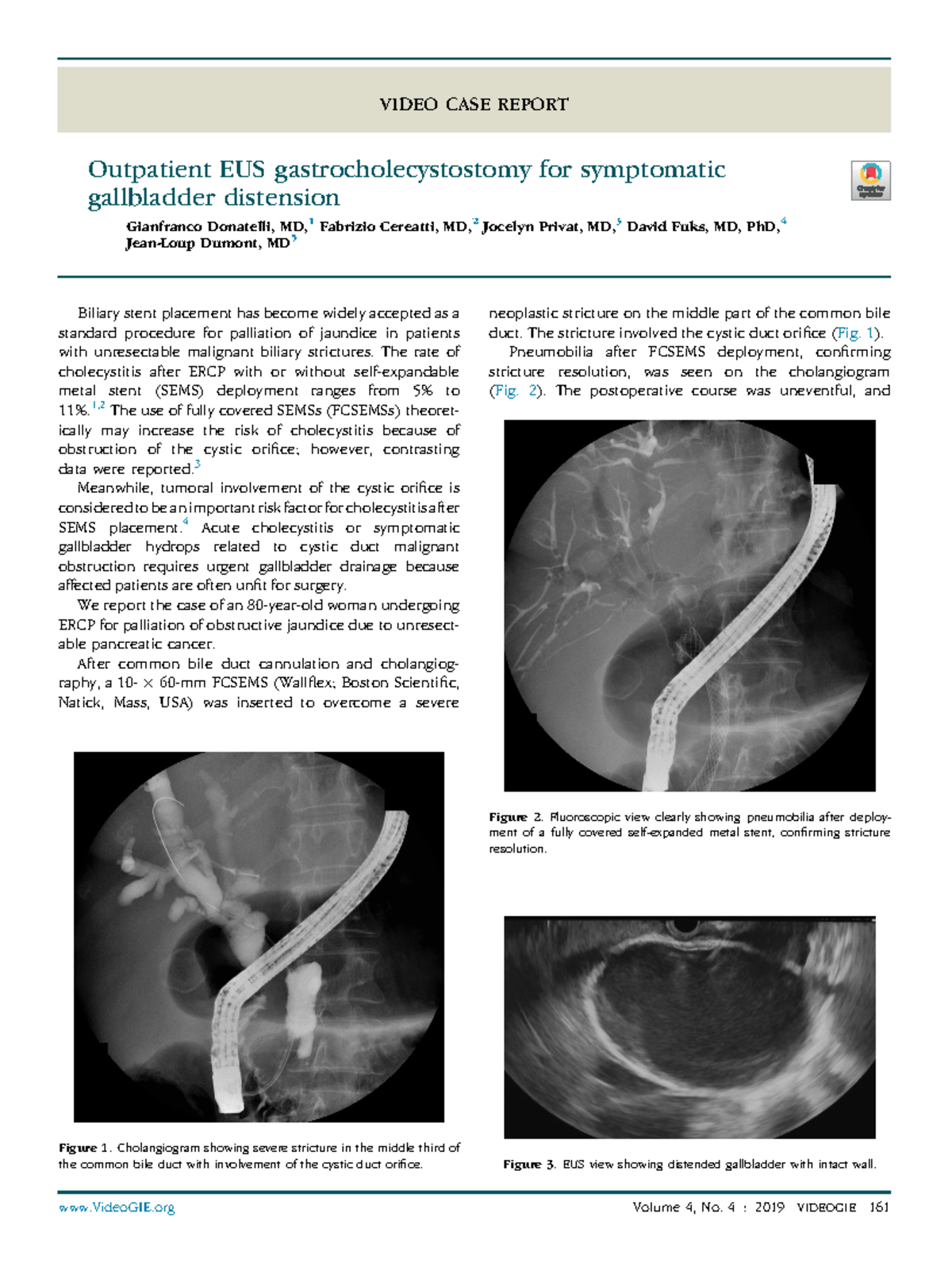 1-s2 - Nota: A - VIDEO CASE REPORT Outpatient EUS gastrocholecystostomy ...
