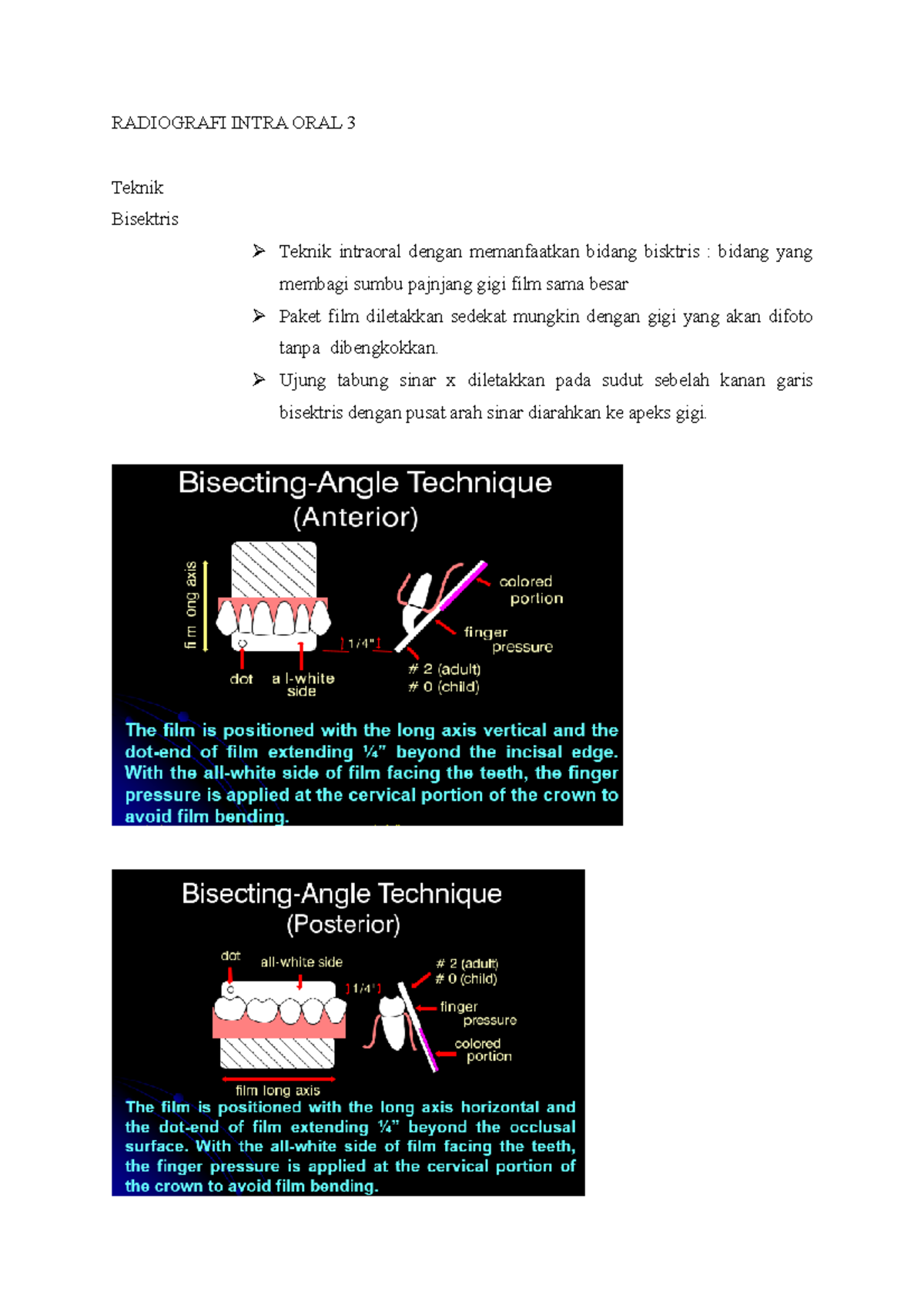 Radiografi Intra Oral 3 - RADIOGRAFI INTRA ORAL 3 Teknik Bisektris Ø ...