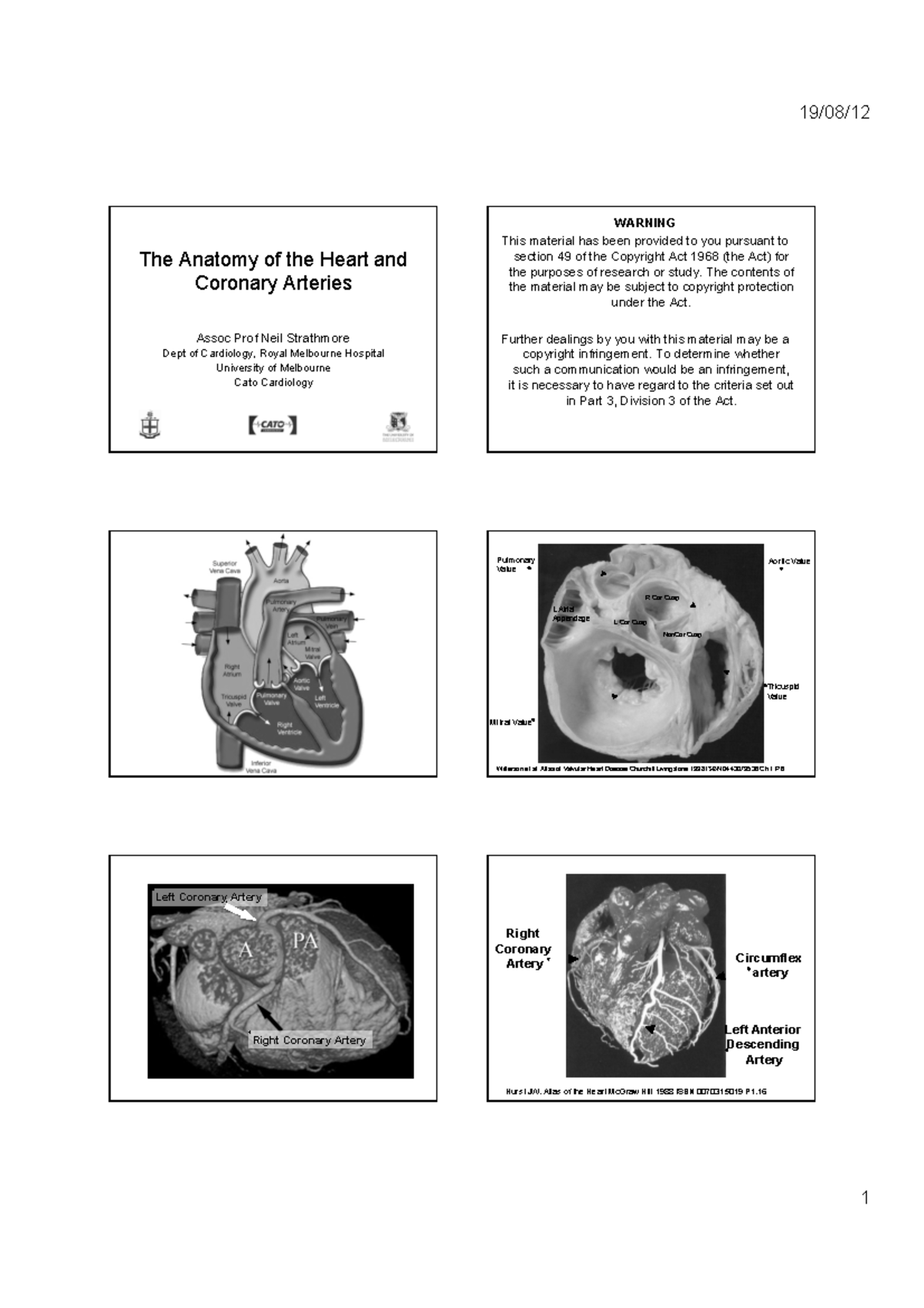 Angiographic Anatomy of the Heart and Coronary - The Anatomy of the ...