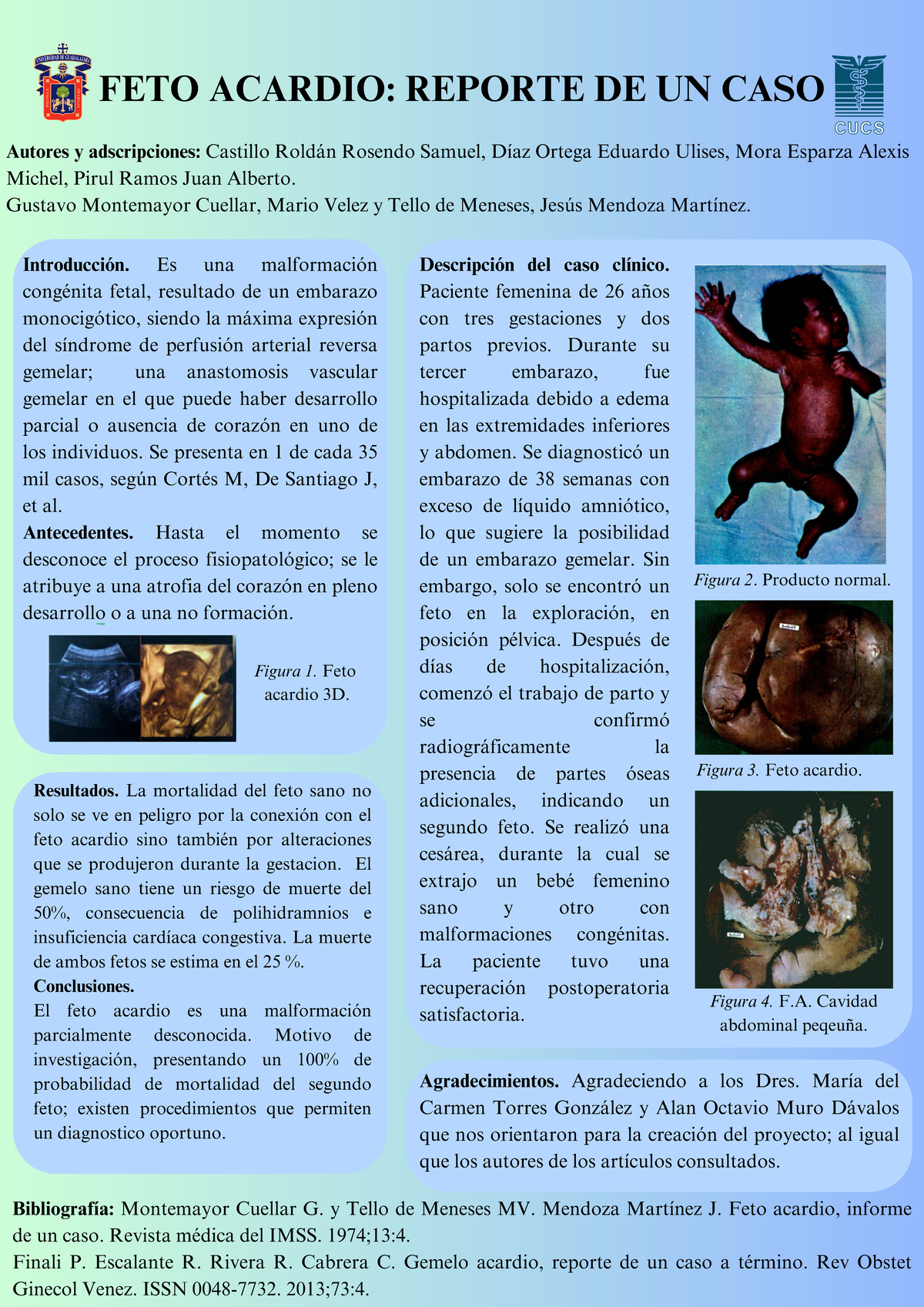 Cartel feto acardio - FETO ACARDIO: REPORTE DE UN CASO Autores y ...