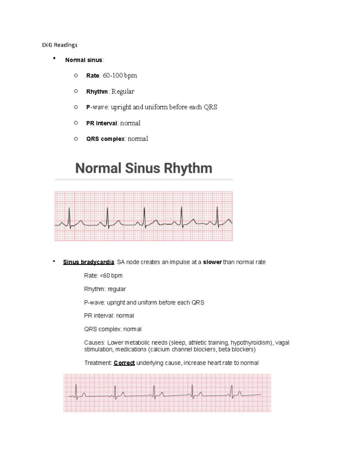 ECG readings - ECG reading explanations - EKG Readings Normal sinus: o ...