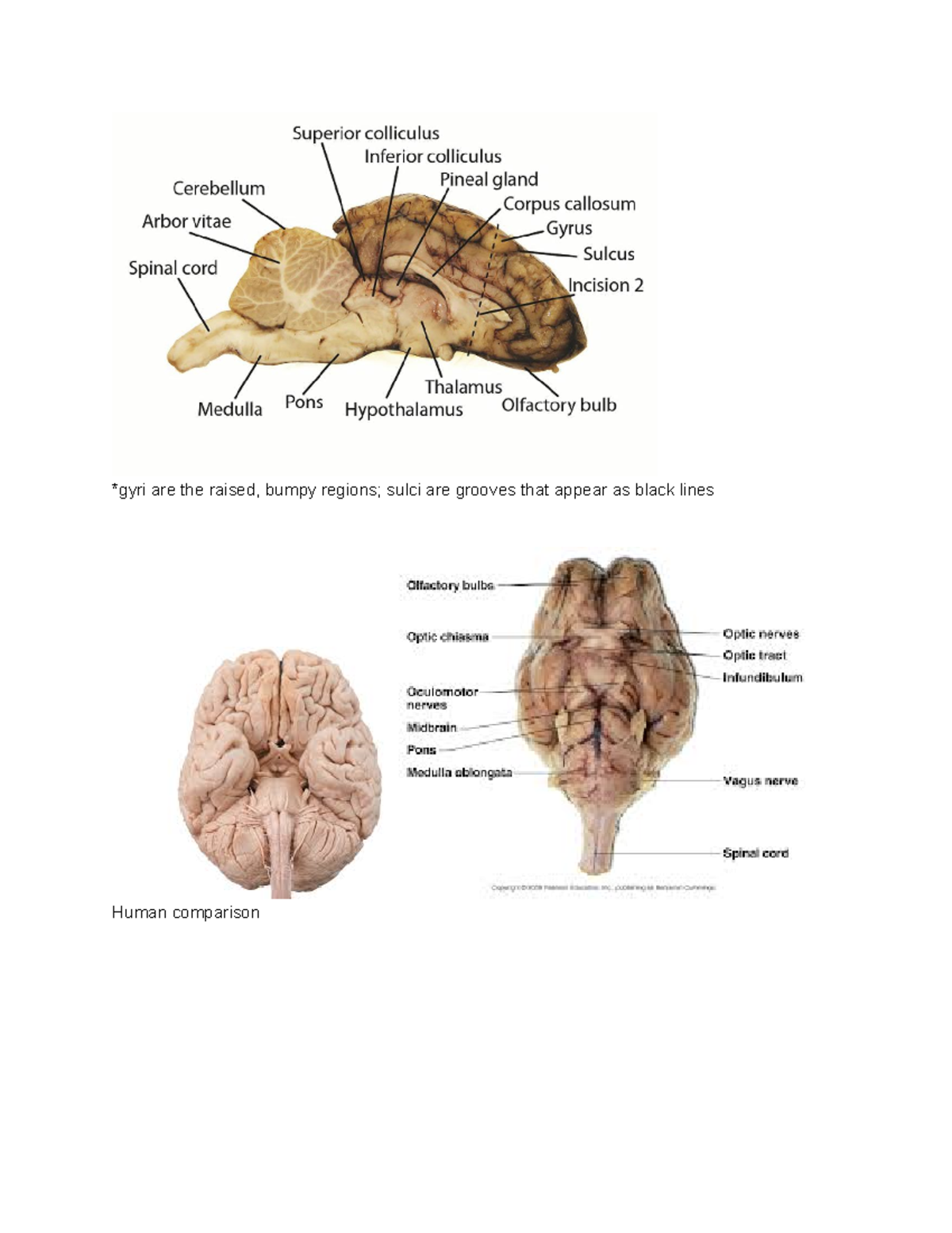 Nervous overview - *gyri are the raised, bumpy regions; sulci are ...