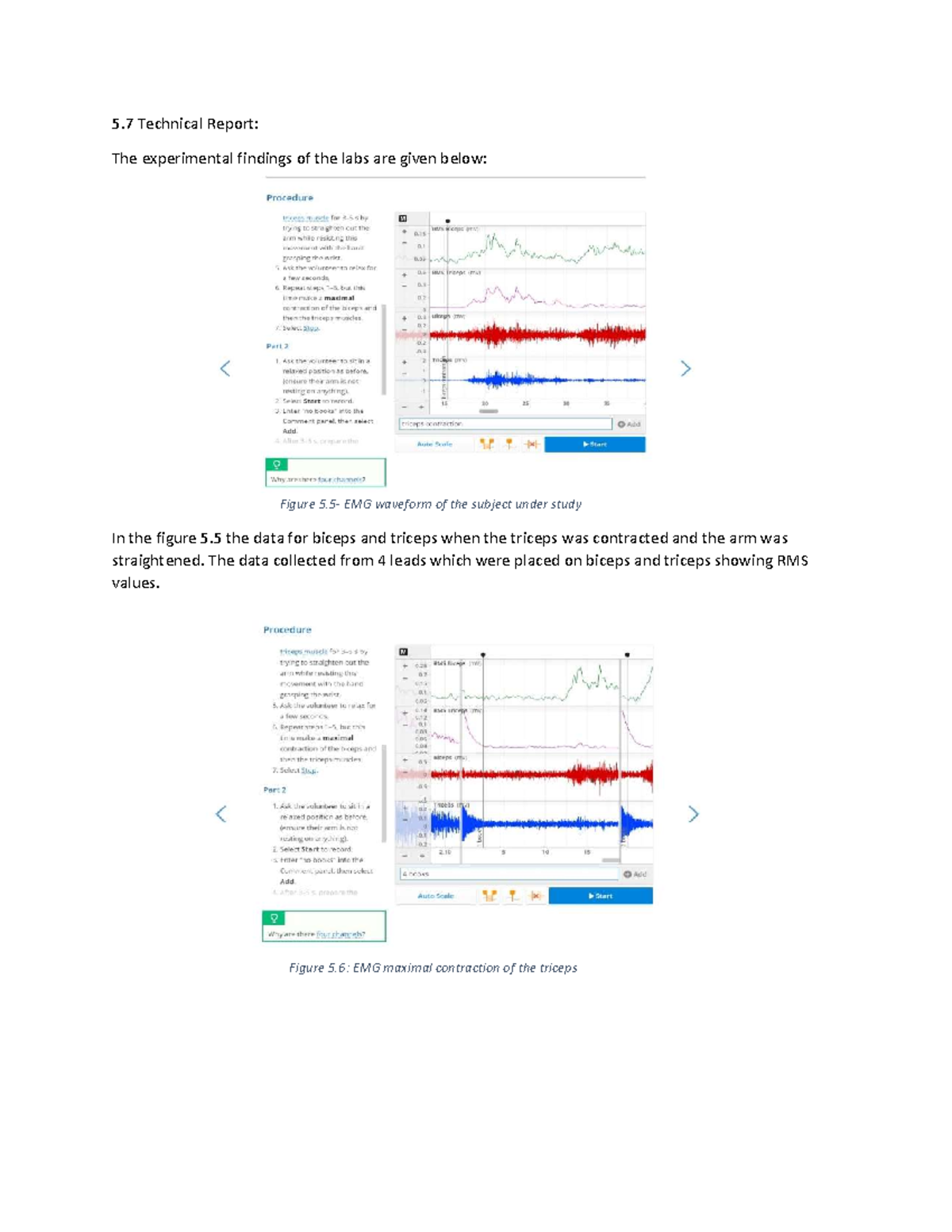 BMI lab-5 - HVY - 5 Technical Report: The experimental findings of the ...