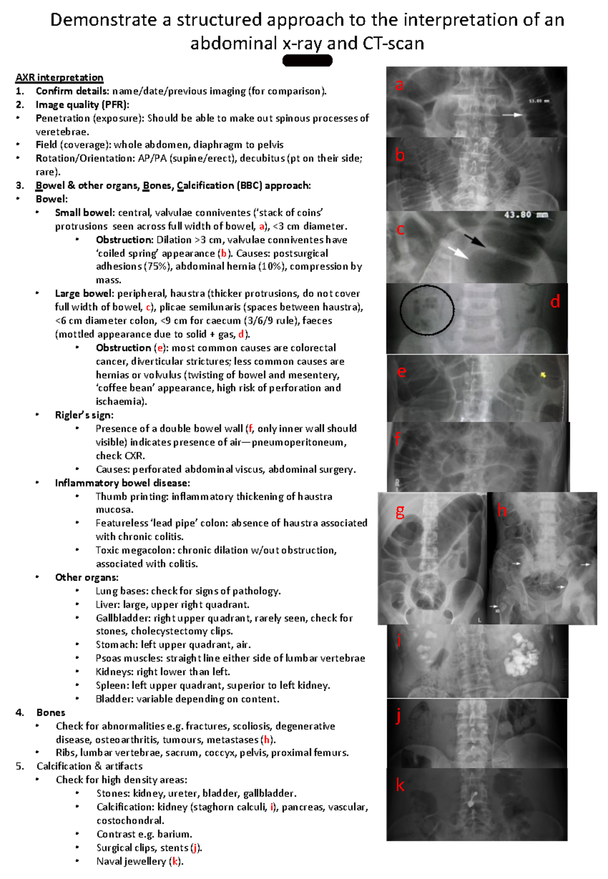 Abdominal X Ray - Demonstrate a structured approach to the ...