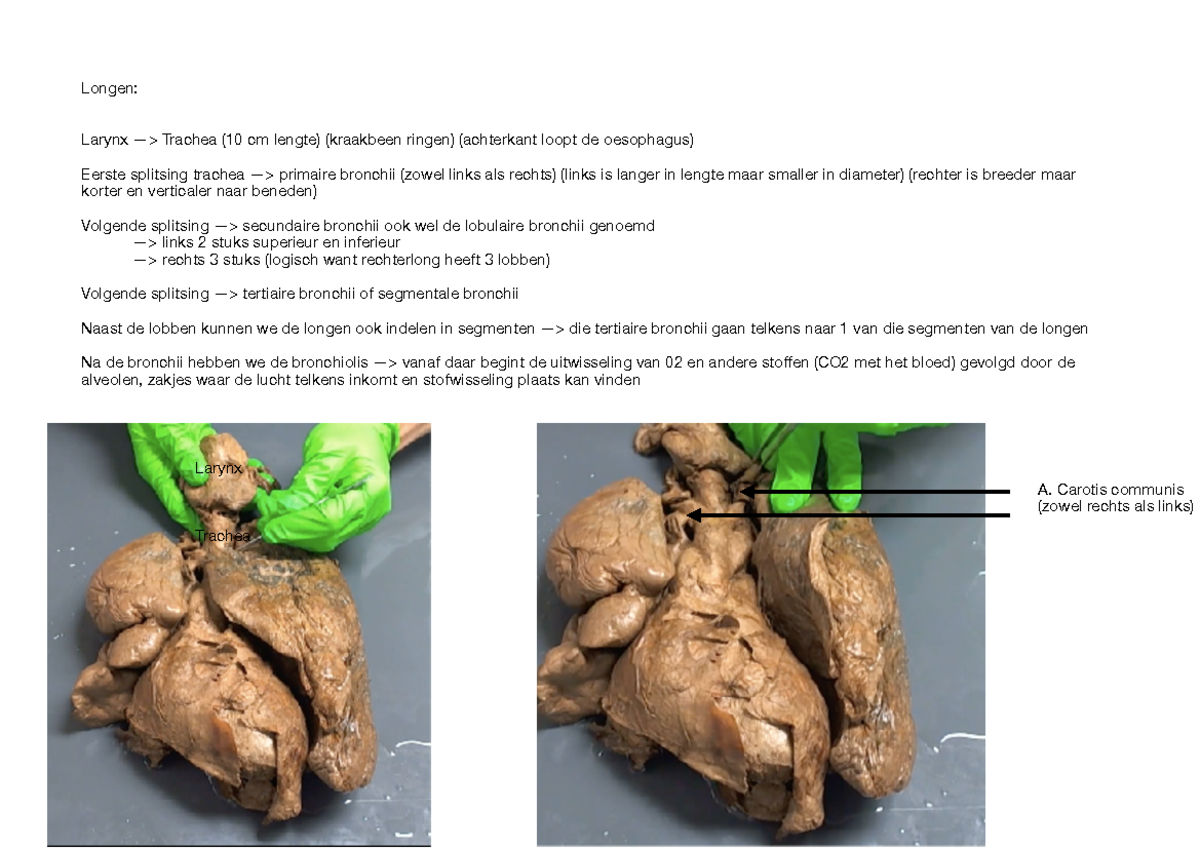 Hart en longen - Longen: Larynx —> Trachea (10 cm lengte) (kraakbeen ...