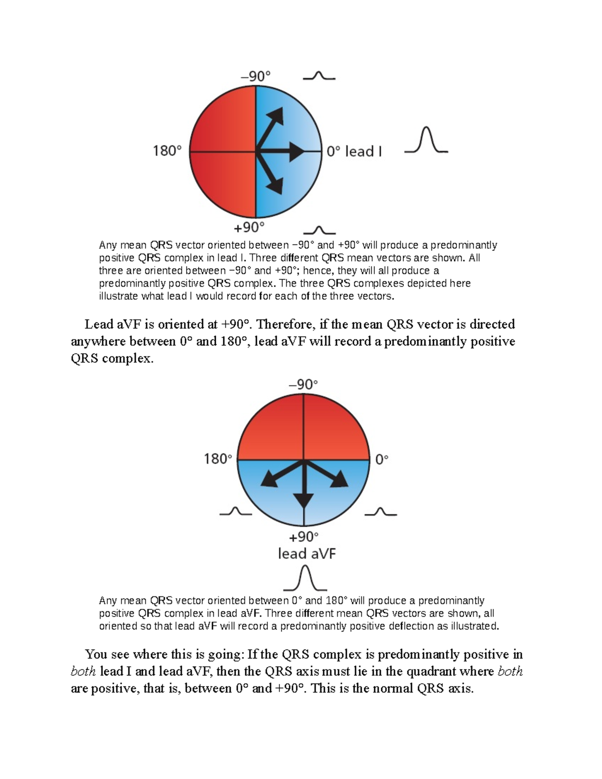 The only EKG-30 - The only EKG - Any mean QRS vector oriented between − ...