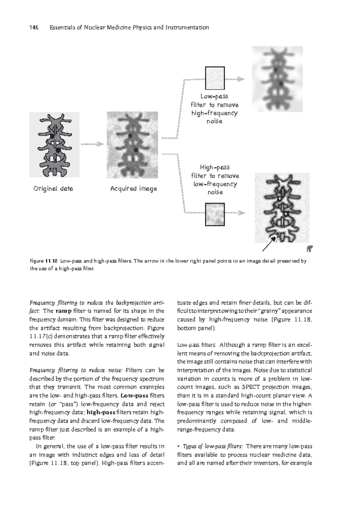 Instrumentation Physics-52 - 146 Essentials of Nuclear Medicine Physics ...