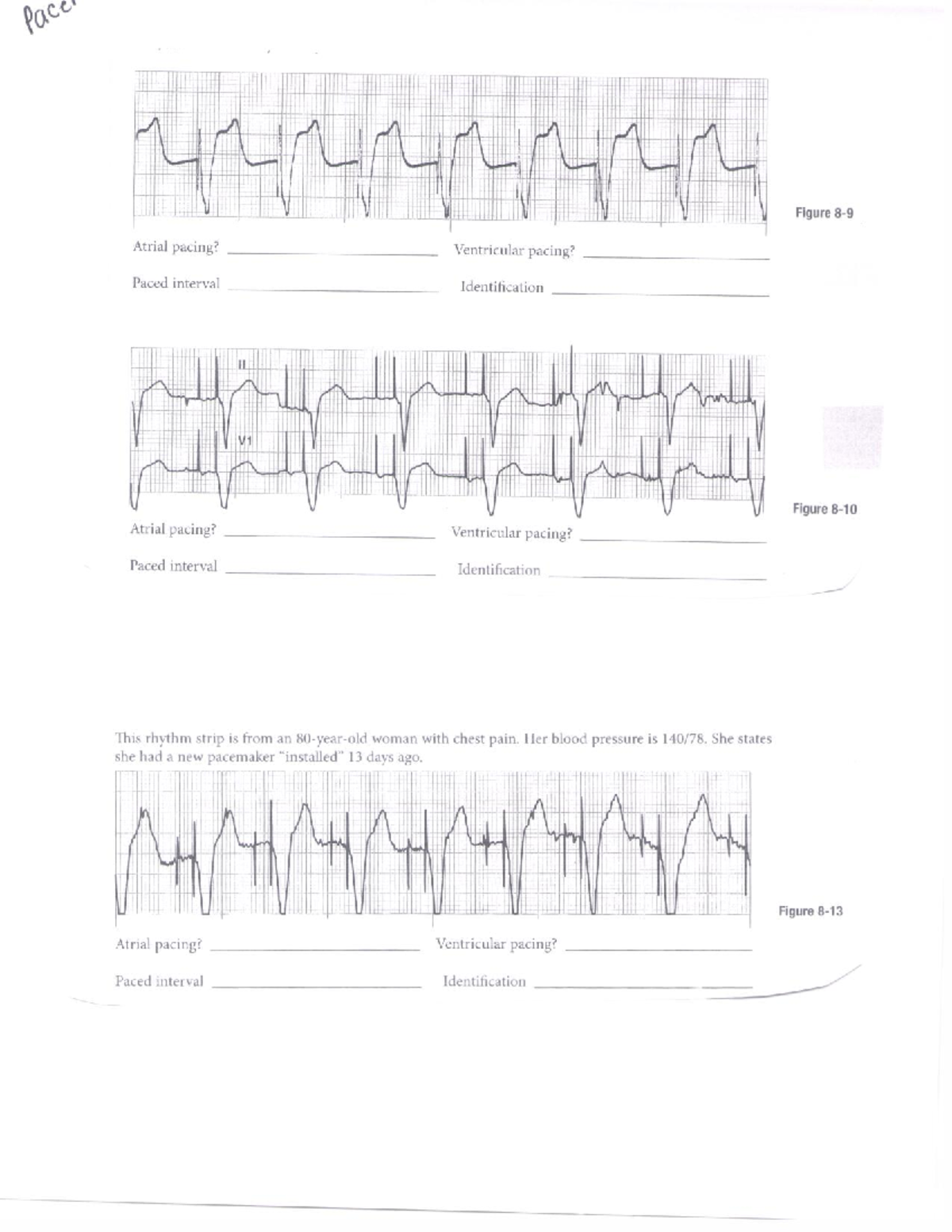 Pacer Strips - pace, Figure Atrial pacing? Ventricular pacing? Paced ...