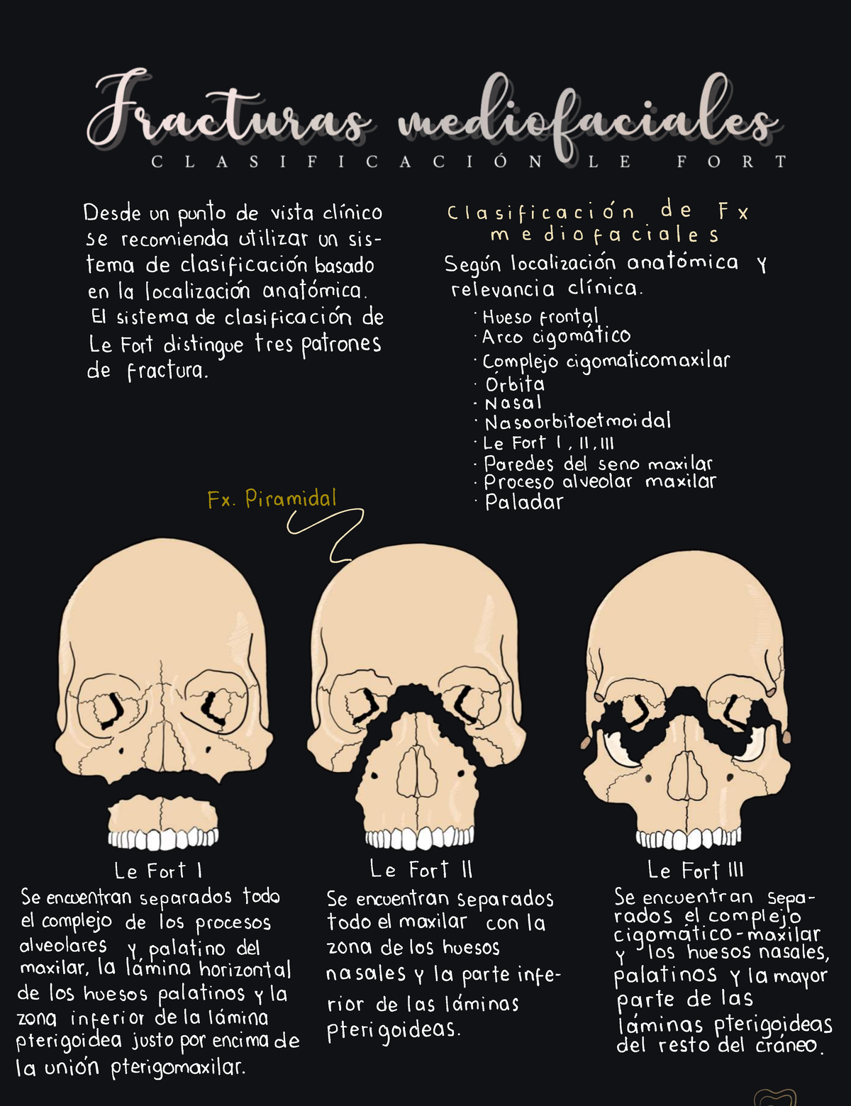 Fracturas de lefort - Baja energÌa Alta energÌa Fracturas simples Con ...