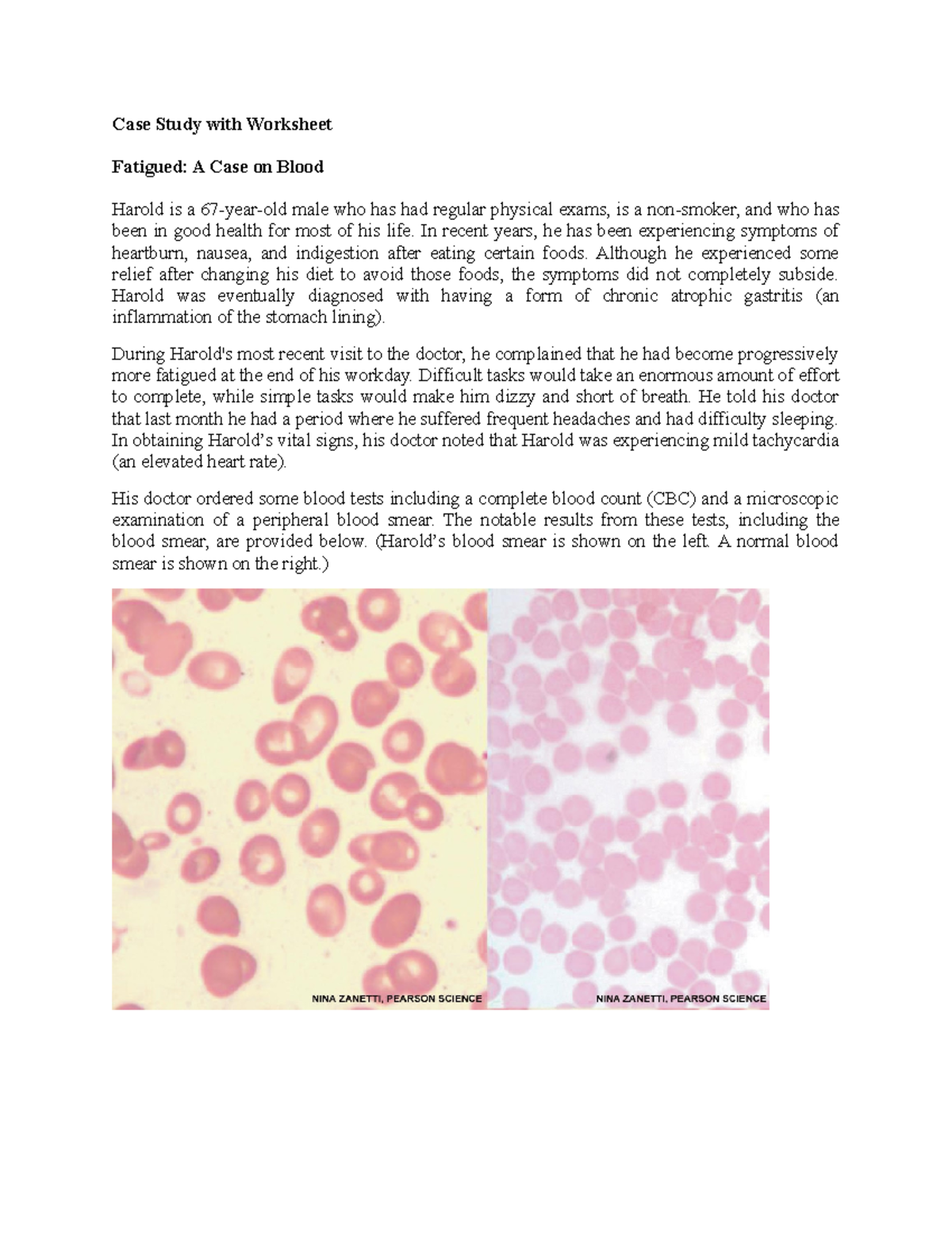 Ch. 19 - Fatigue case 2 - Case Study with Worksheet Fatigued: A Case on ...