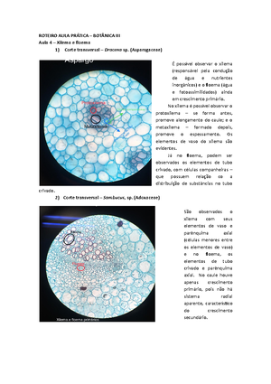 Relatório Anatomia Vegetal - Esclerênquima e Colênquima - Anatomia ...