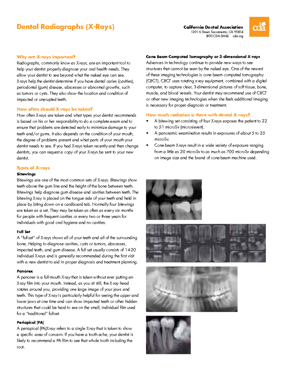 Xrays english - Dental X-ray - Dental Radiographs Why are important ...