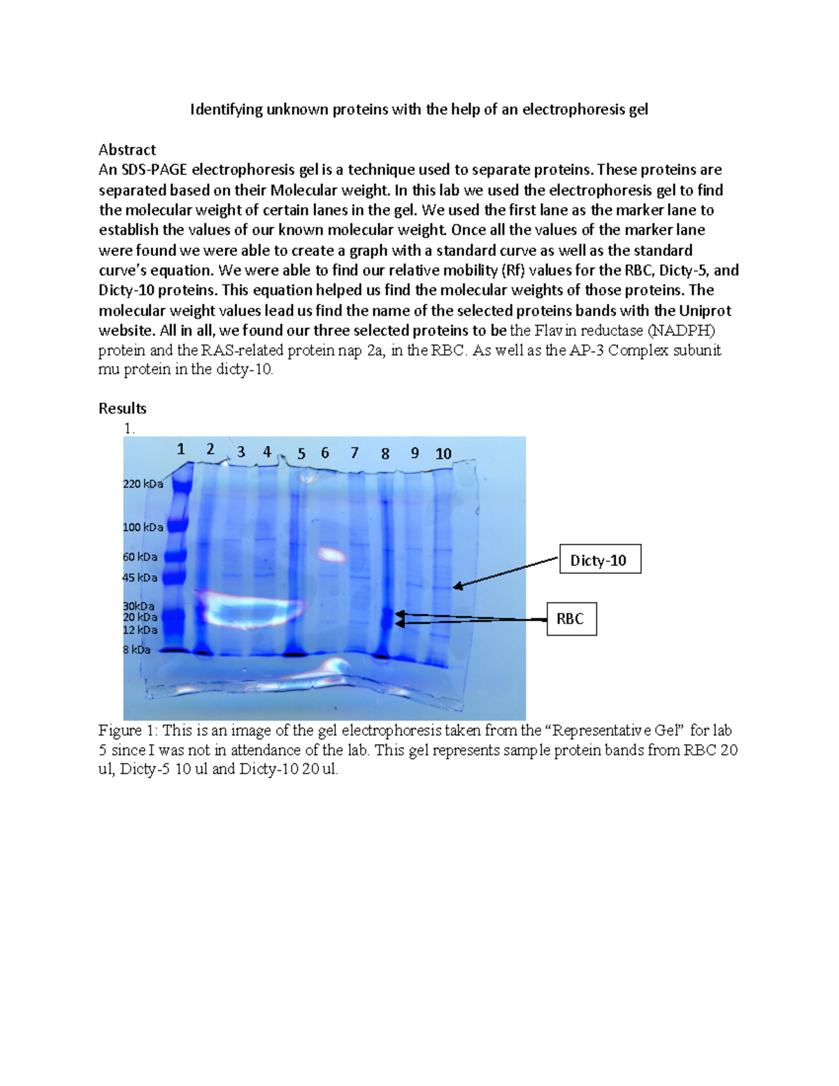Identifying unknown proteins with the help of an electrophoresis gel ...