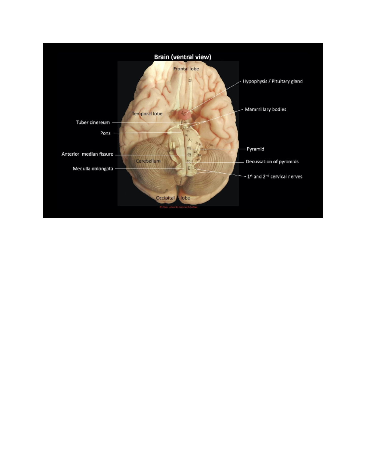 Ventral brain - anatomy - Brain (ventral view) Frontal lobe Hypophysis ...