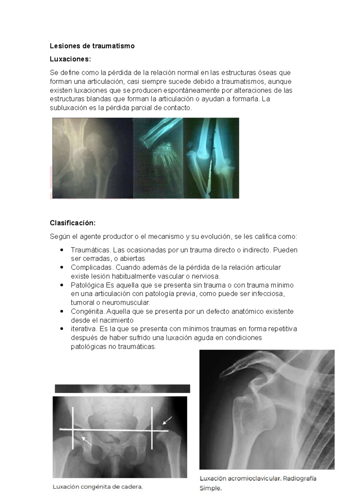 Lesiones de traumatismo - Lesiones de traumatismo Luxaciones: Se define ...