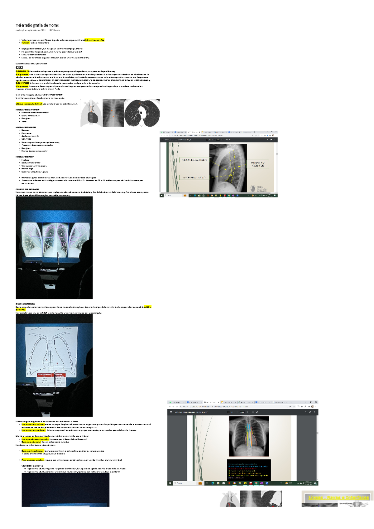 Rx de torax - •Se toma en proyeccion PA que la parte anterior pegada al ...
