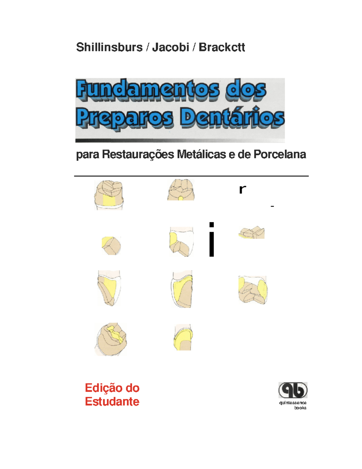 Fundamentos de Protese Fixa Shillingburg - Shillinsburs / Jacobi ...