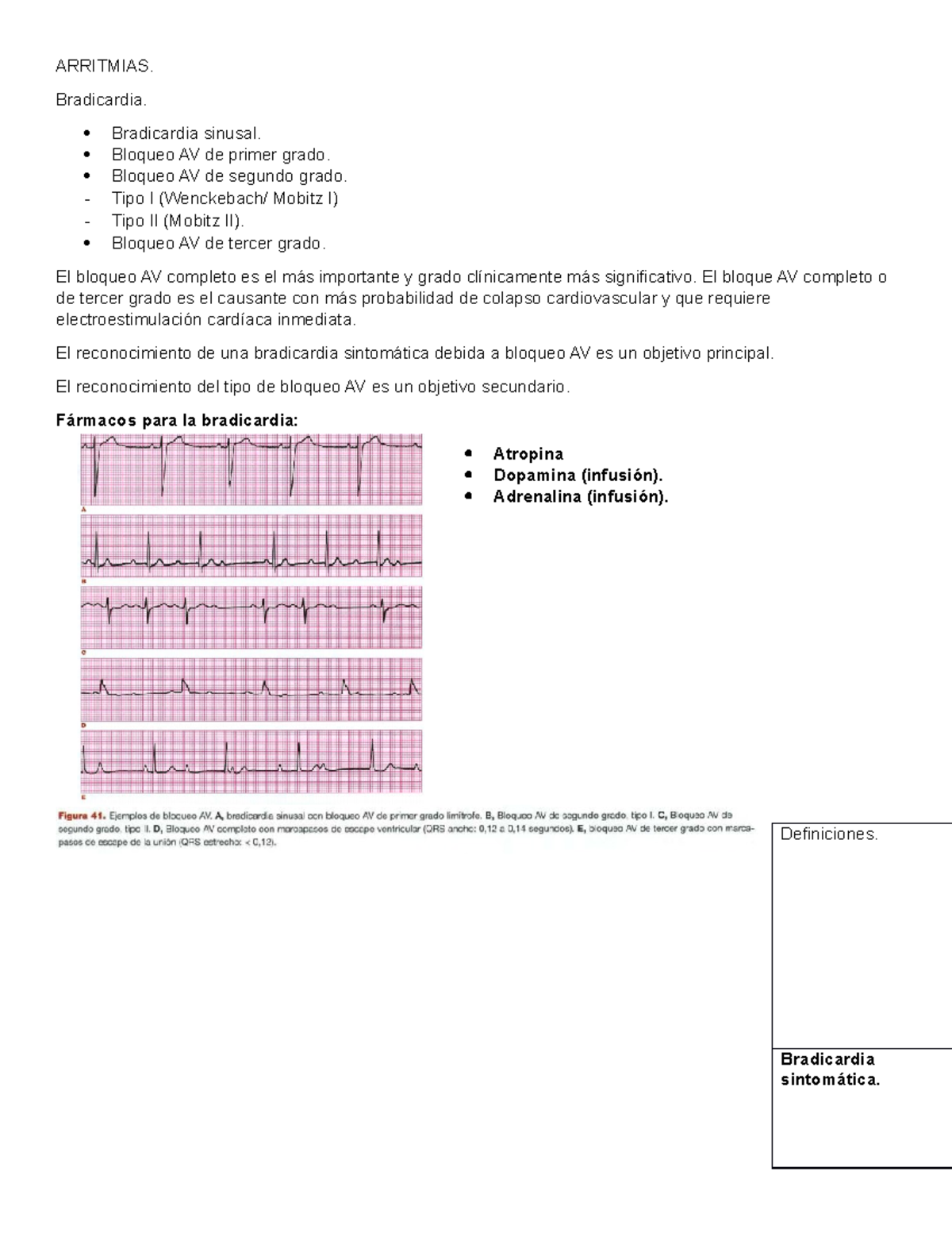 Arritmias - ARRITMIAS. Bradicardia. Bradicardia sinusal. Bloqueo AV de ...