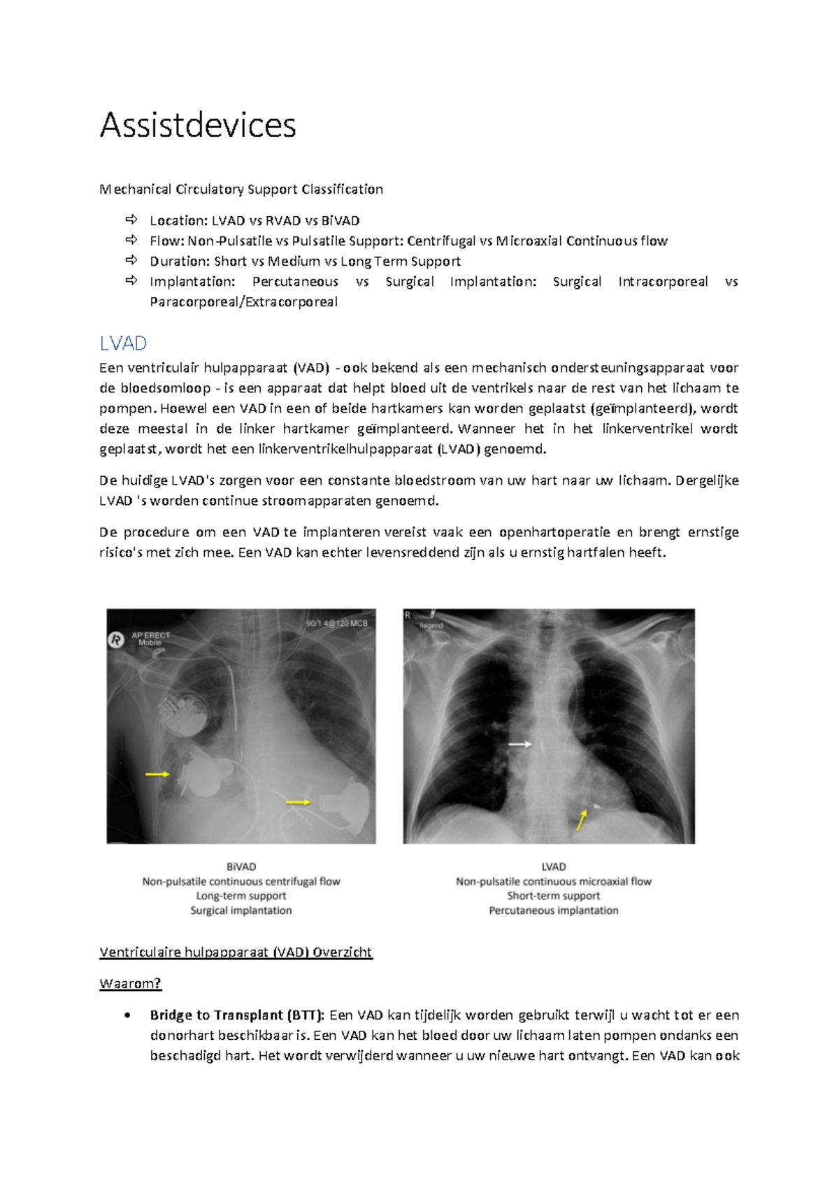 Assistdevices - Assistdevices Mechanical Circulatory Support ...