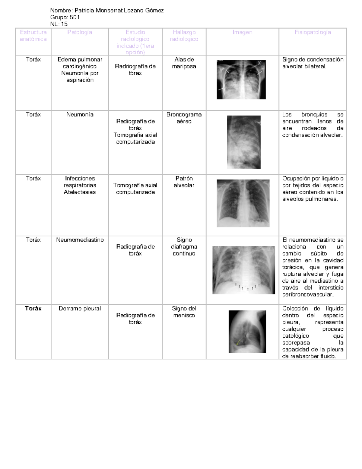 Hallazgos radiológicos - Nombre: Patricia Monserrat Lozano Gómez Grupo ...