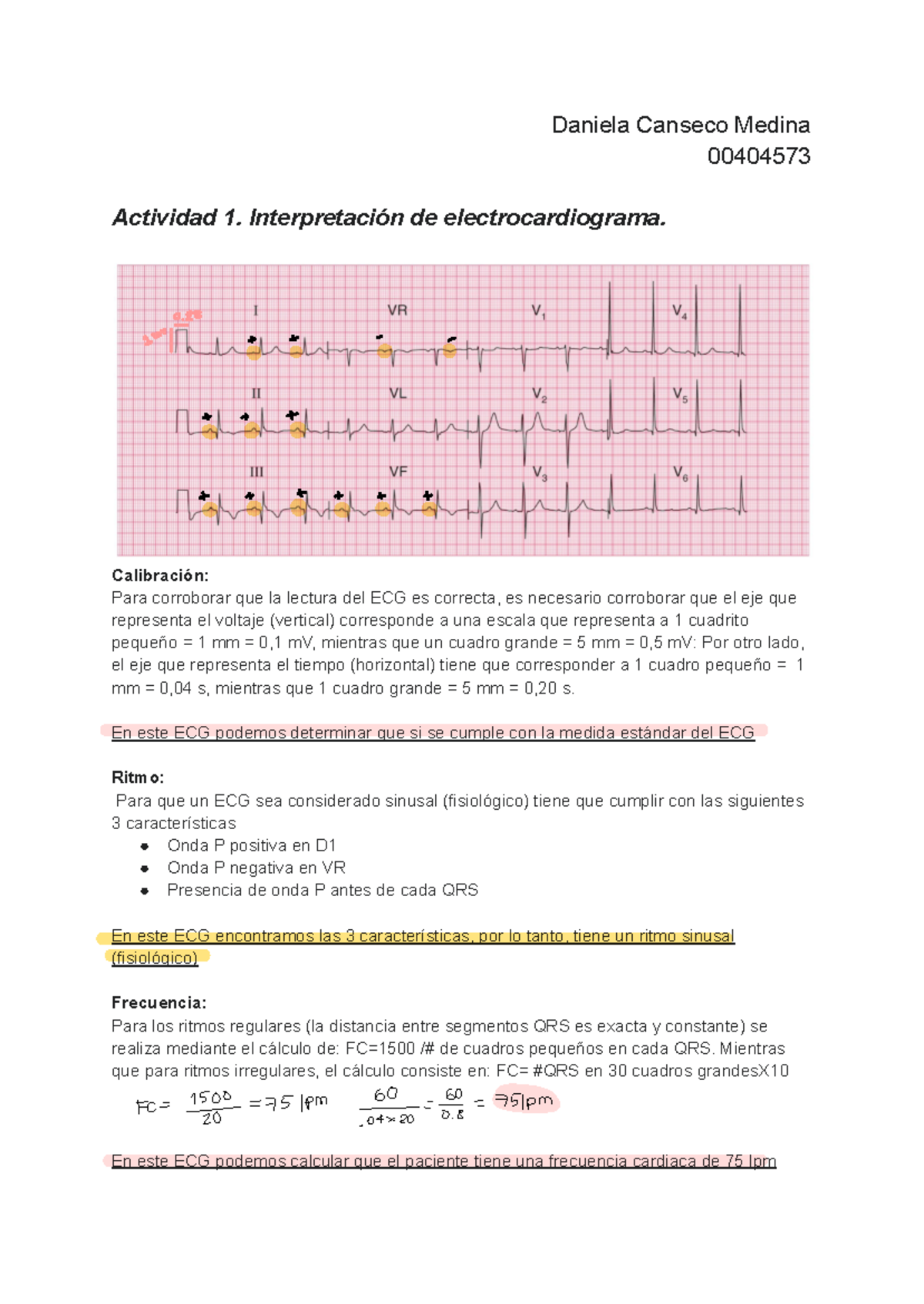 Actividad 1 ECG 2 - Daniela Canseco Medina 00404573 Actividad 1 ...
