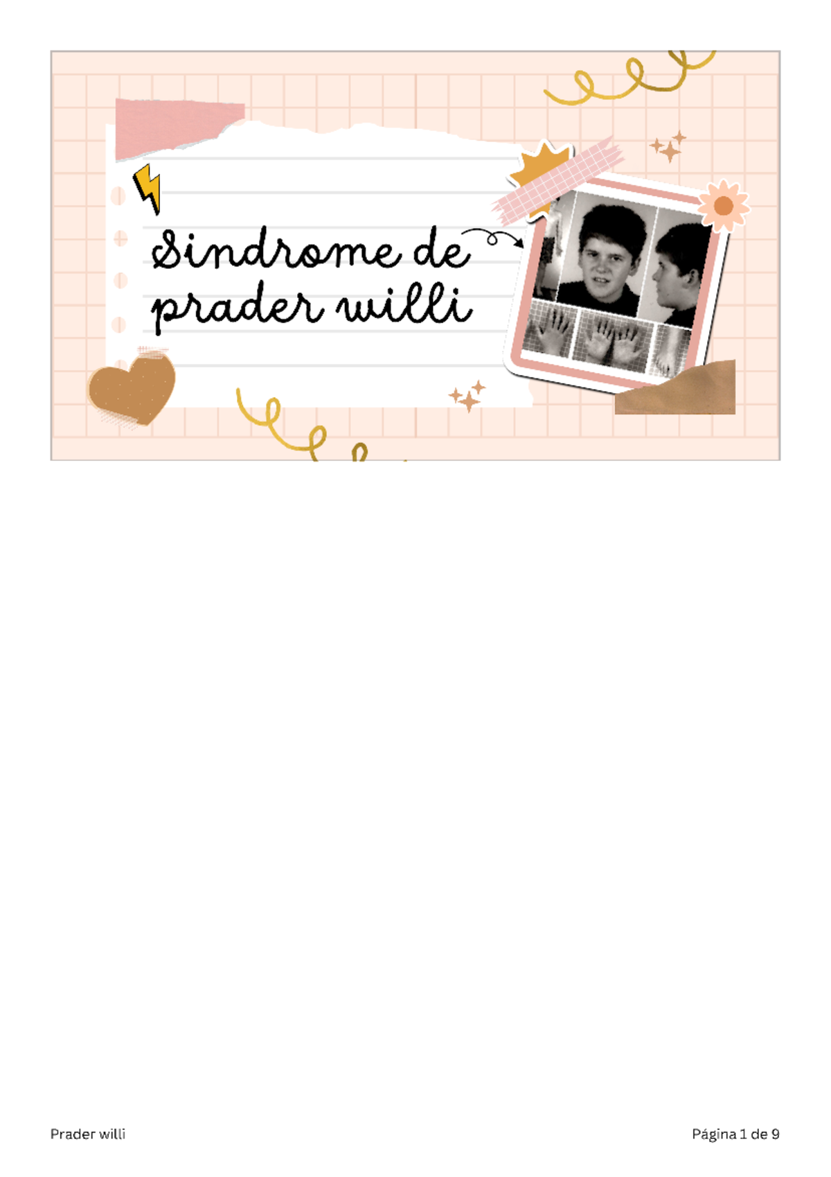 Prader willi 20240623 205151 0000 - w 4 Sindrome de prader willi Prader ...